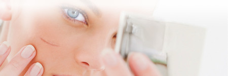 Littekens - Mary Smits | Huid- en Lasertherapie